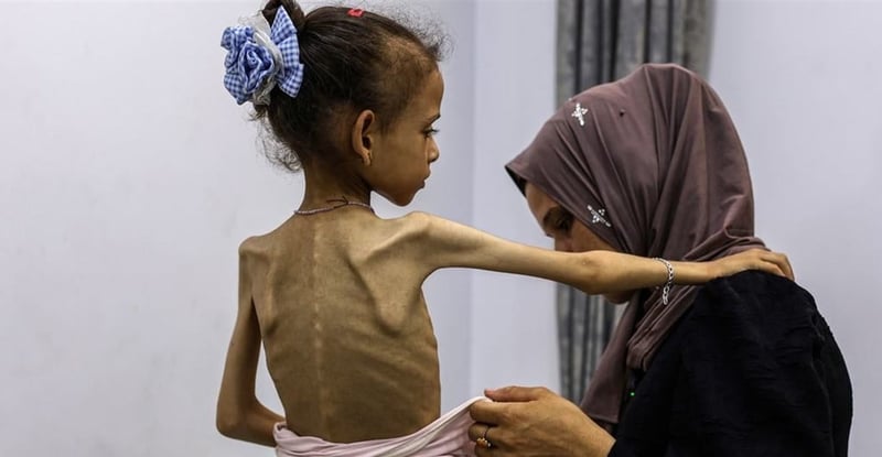 The Science of Starvation Understanding How Food Deprivation Impacts ...