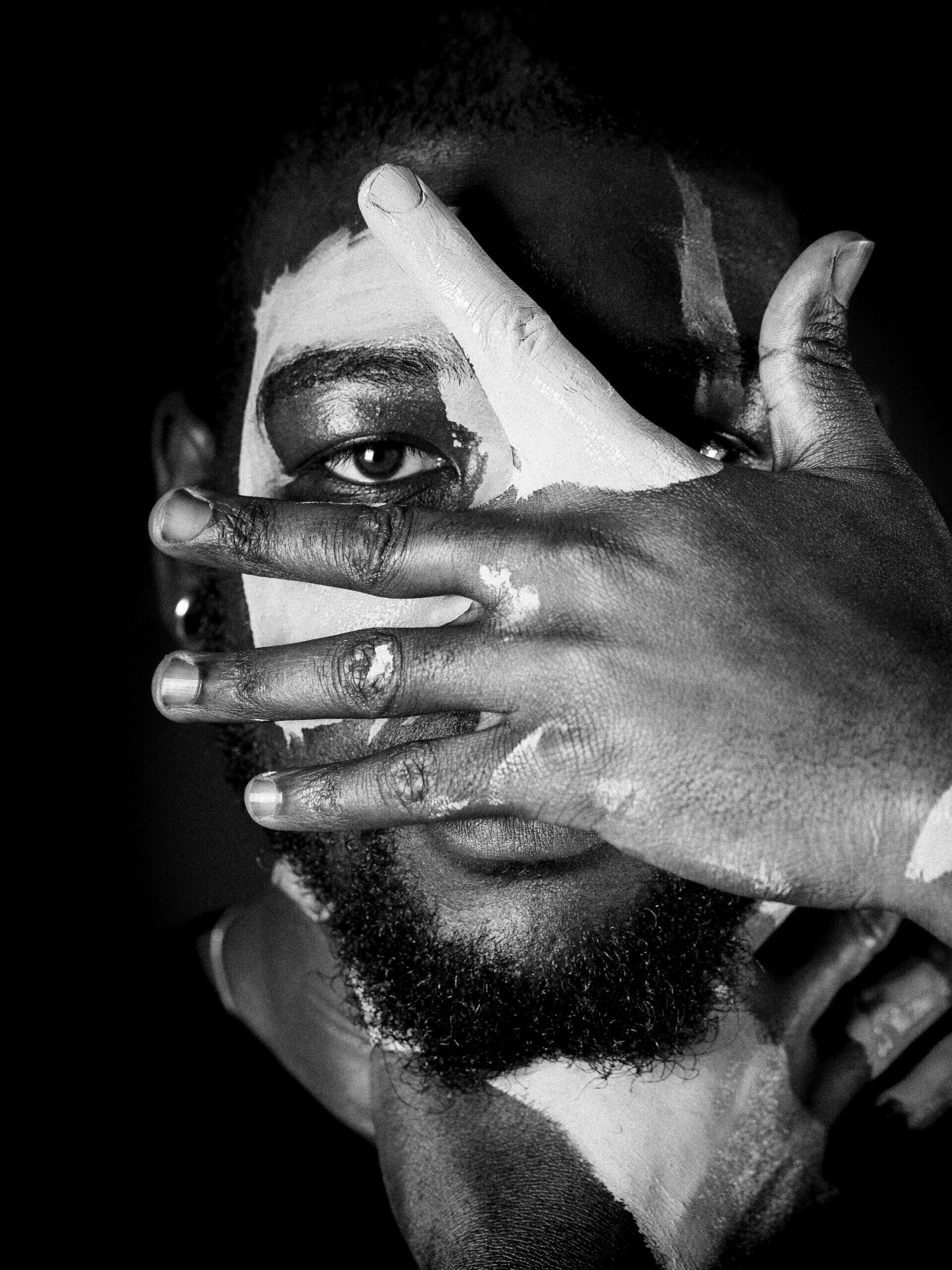 Dr Judey’s Guide to a Bump-Free Movember Addressing Ingrown Hairs and ...