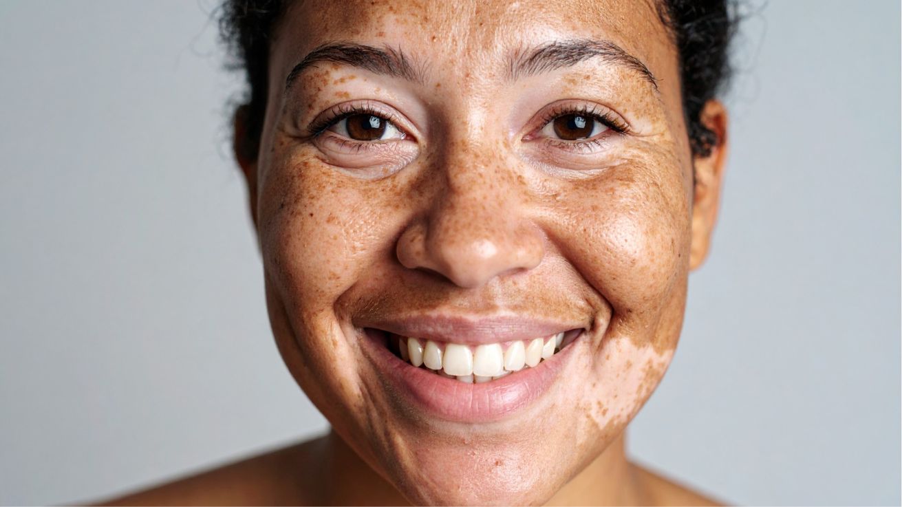 Dove Leads Positive Change With Generative AI Campaign Addressing ...